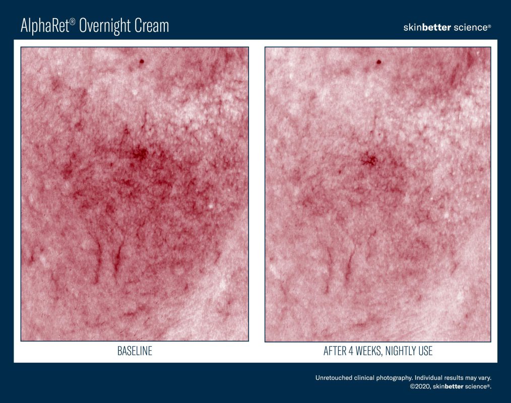 AlphaRet Overnight Cream, 30 ml - BVAC