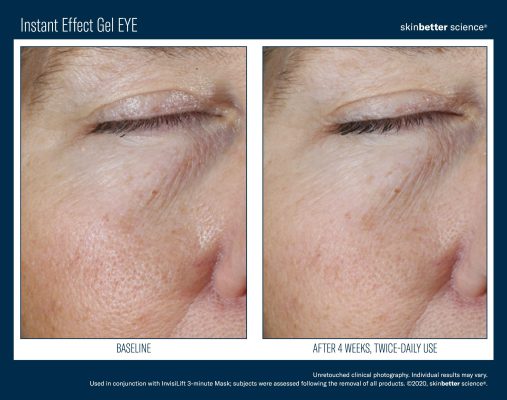 Instant Effect Gel Eye - BVAC